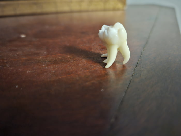 A tooth they pulled. They said it was the longest roots they have ever ...