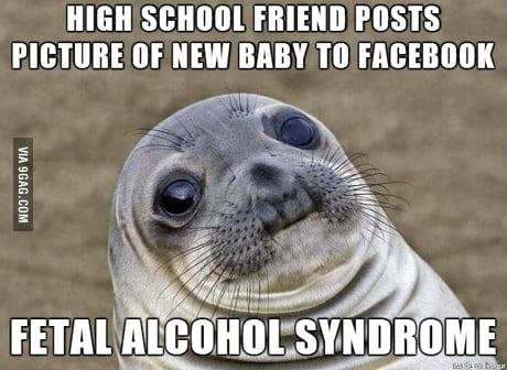 Fetal Alcohol Syndrome Memes 🅱️ 25+ Best Memes About Midface
