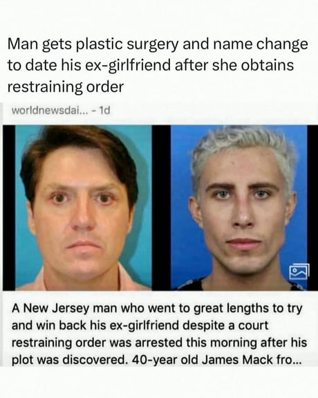 Plastic Surgery Wife Memes