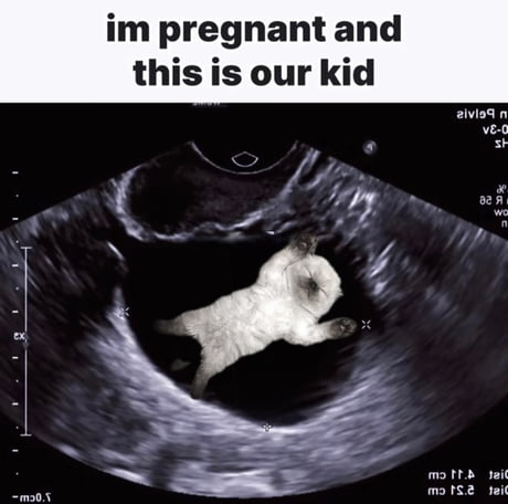 Best Funny ultrasound Memes - 9GAG