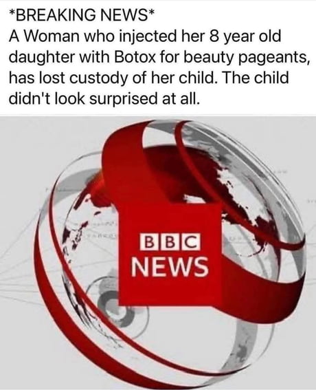 Best Funny botox Memes - 9GAG