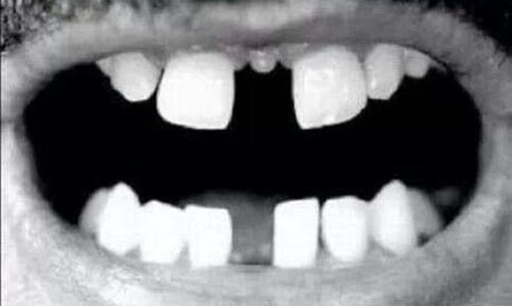 Best Funny dentist Memes - 9GAG