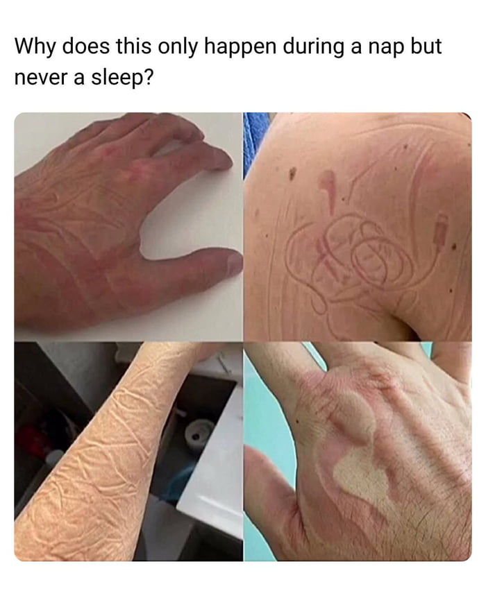 Waking up with a new skin pattern, nap art - 9GAG