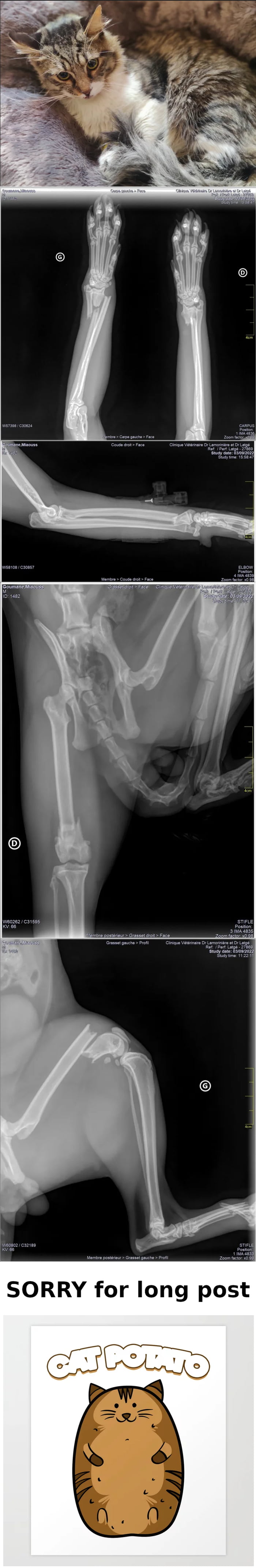 4 broken legs after 8th floor fall... - 9GAG