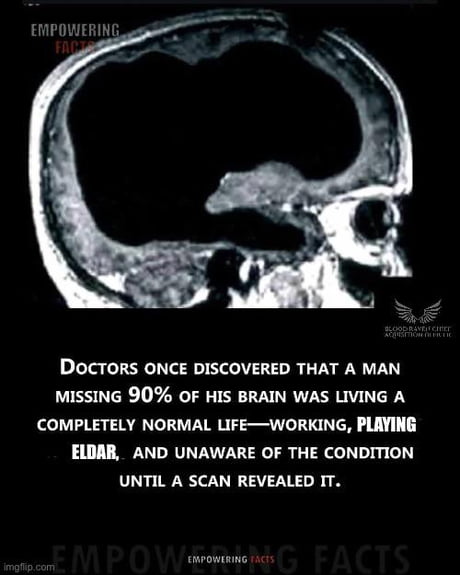 Best Funny neurology Memes - 9GAG
