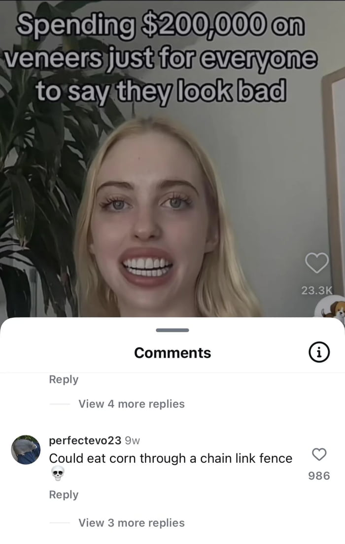 Keep your teeth natural guys - 9GAG