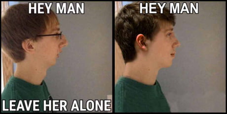 Nose Job Memes