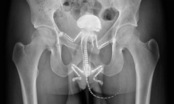 Unbelievable case here - x-ray scan shows baby monkey stuck in 60 years ...