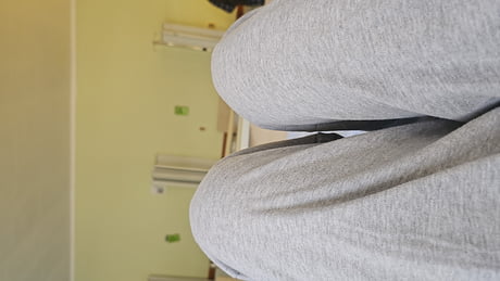 Best Funny gallbladder Memes - 9GAG