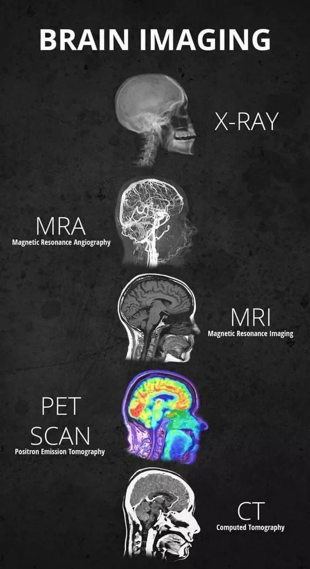 Different brain "scan" methods - 9GAG