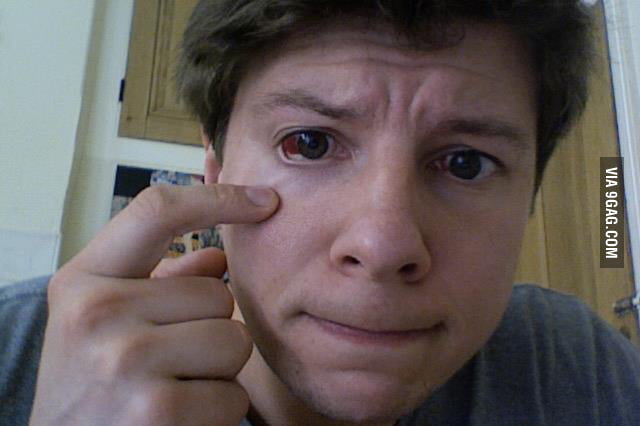 Folks, this is why you shouldn't try to sneeze with your eyes open. - 9GAG