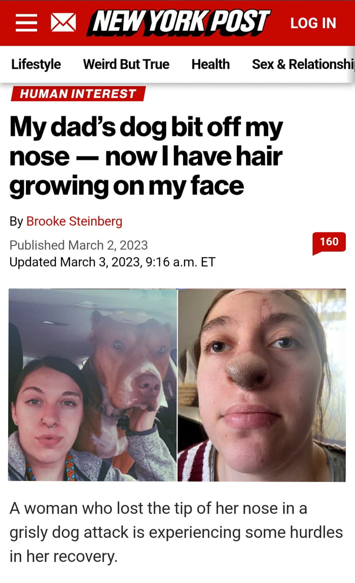 Family pit bull ripped off woman's nose - 9GAG
