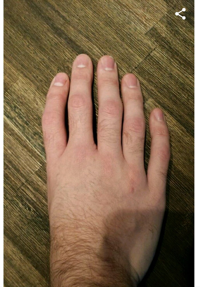 Hand or Feet ?? - 9GAG