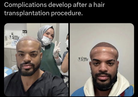 Best Funny hair Memes - 9GAG