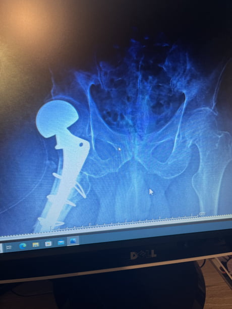 Best Funny x ray Memes - 9GAG