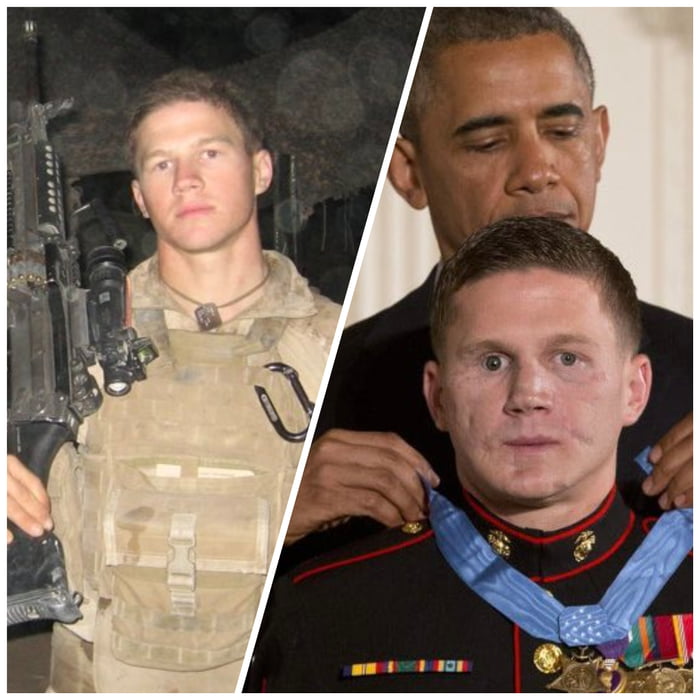 The transformation of Kyle Carpenter before and after sustaining ...