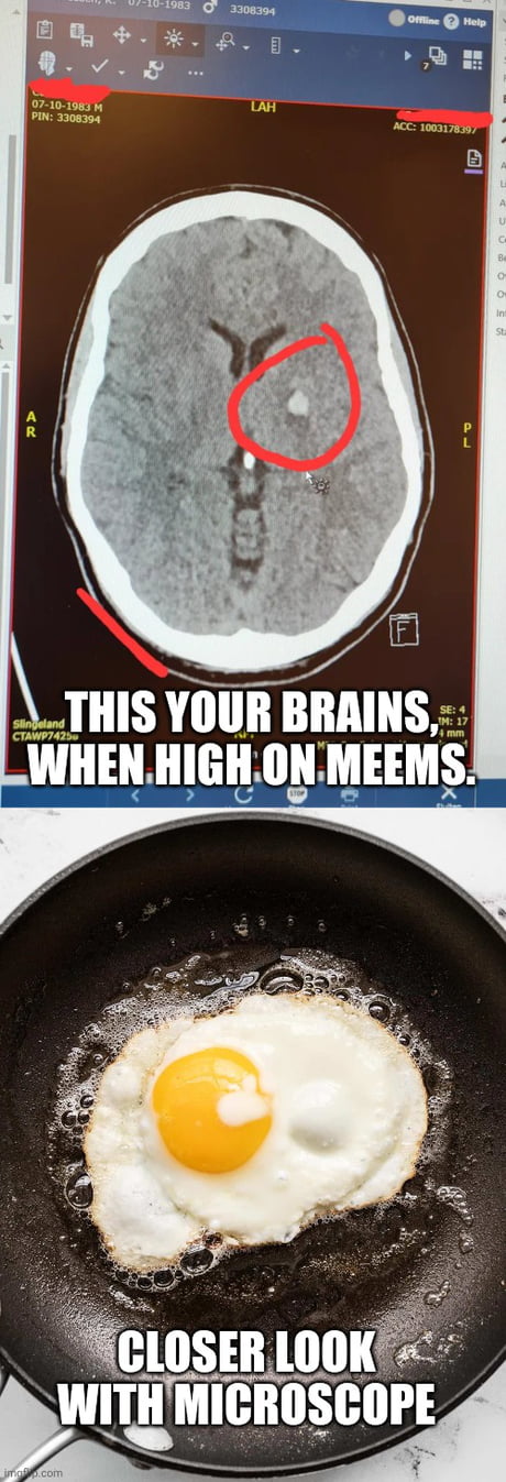 Best Funny brainrot Memes - 9GAG
