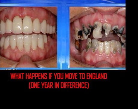 I googled British teeth memes - 9GAG