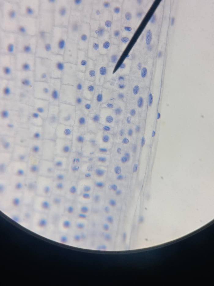 An onion root magnified by 40X on a microscope, you can see the ...
