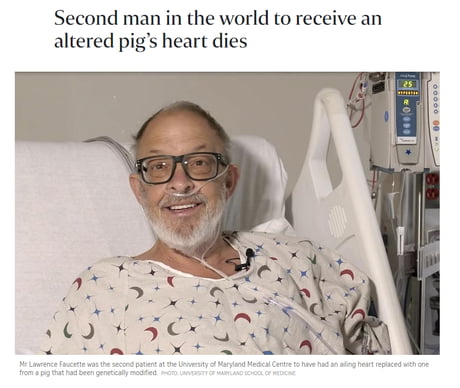 Best Funny transplant Memes - 9GAG