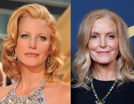 Anna Gunn Plastic Surgery Before And After Emmys Played Out Like A