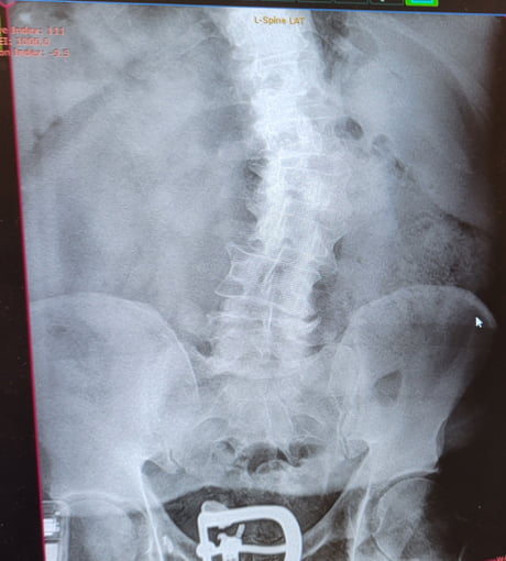 Best Funny back pain Memes - 9GAG