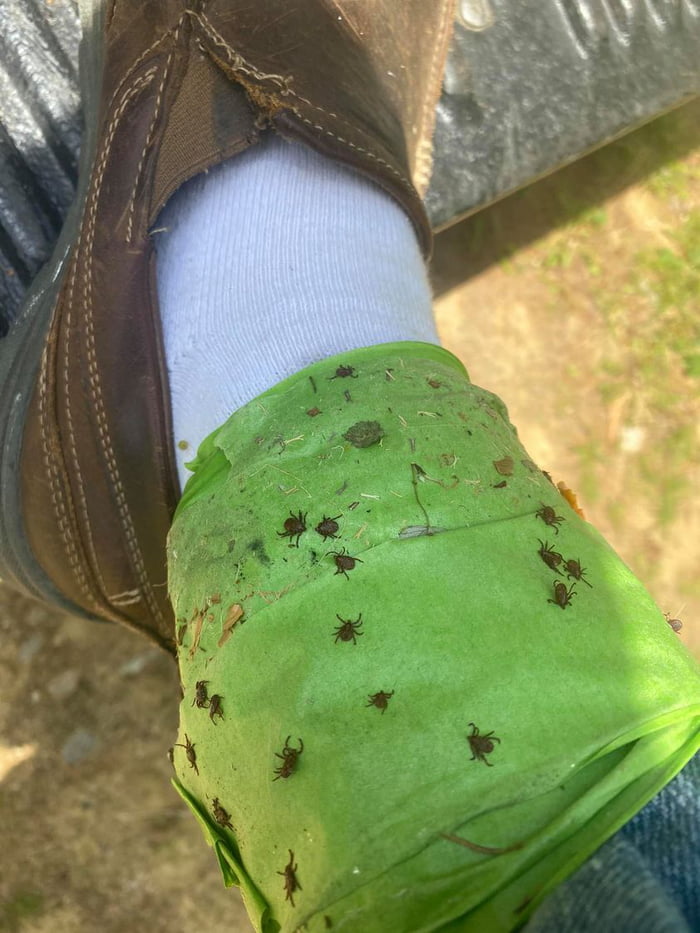 Ticks stuck to sticky tape wrapped around an ankle, always check for ...
