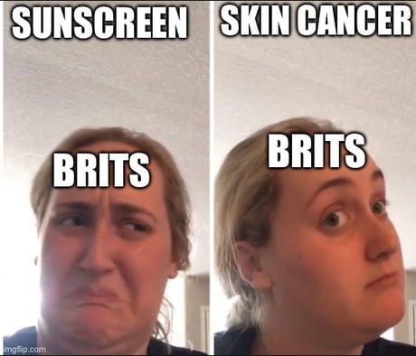 Funny Sunburn Meme