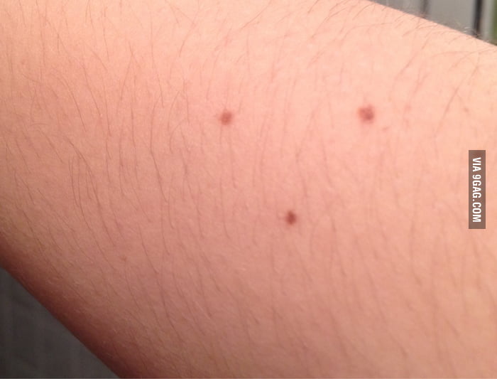 New Mole On Arm Makes A Triangle Guess I m Illuminati Now 9GAG new-mole-on-arm-makes-a-triangle-guess-i-m-illuminati-now-9gag
