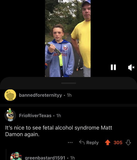 Fetal Alcohol Syndrome Memes