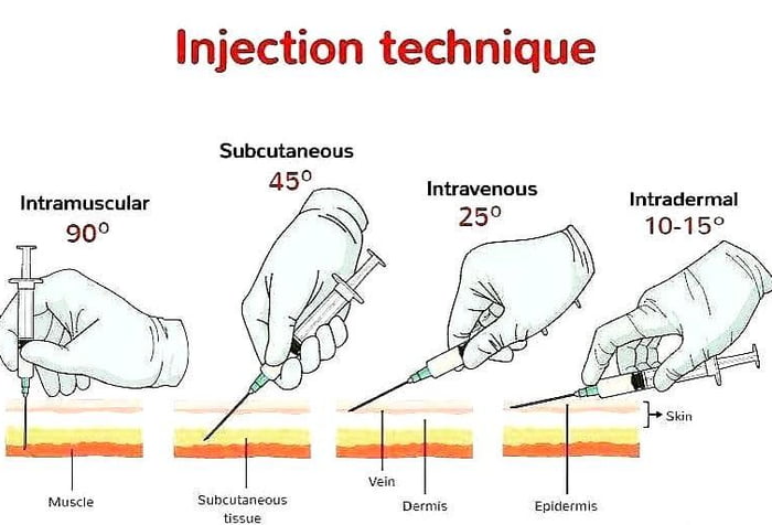 A cool guide on Injection techniques. - 9GAG