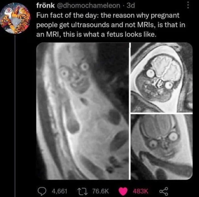 Fetus....... - 9GAG