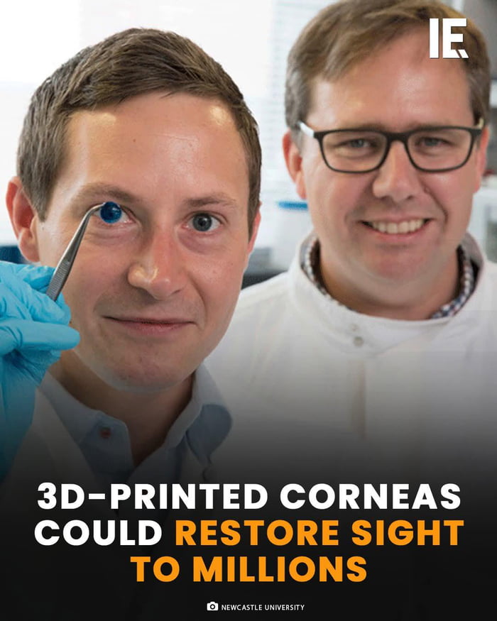 Incredible progress! 3D-printed corneas could bring sight back to ...
