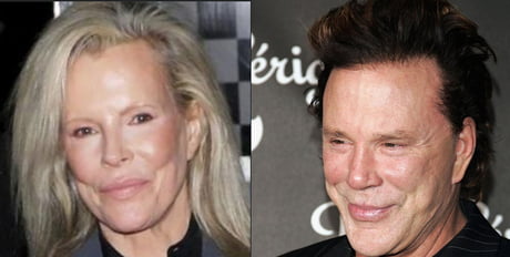 Best Funny plastic surgery Memes - 9GAG