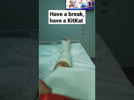 Best Funny broken leg Memes - 9GAG