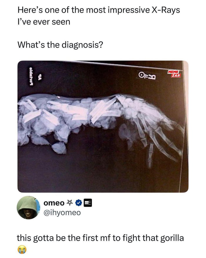 At that point, they just did the x-ray for fun - 9GAG