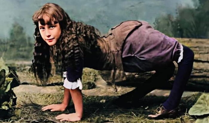 Ella Harper, aka Camel Girl, was born with a rare condition that caused ...