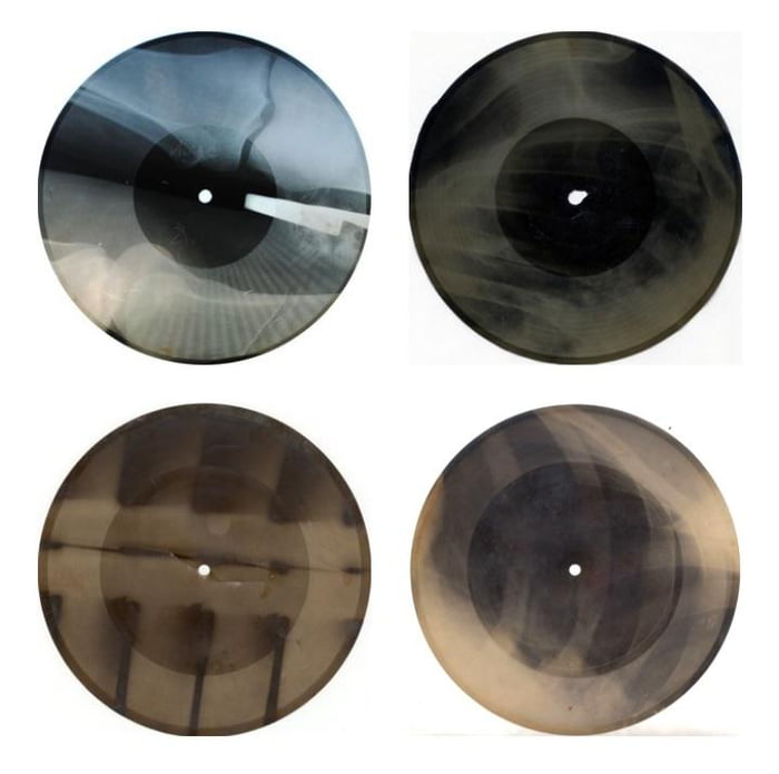 These are called "Bone Records". In soviet Russia music was heavily ...