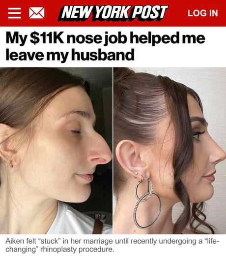 Nose Surgery Memes