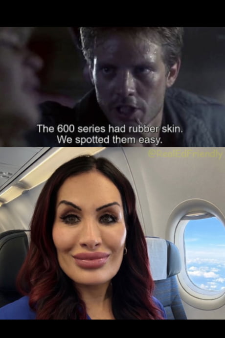 Best Funny botox Memes - 9GAG
