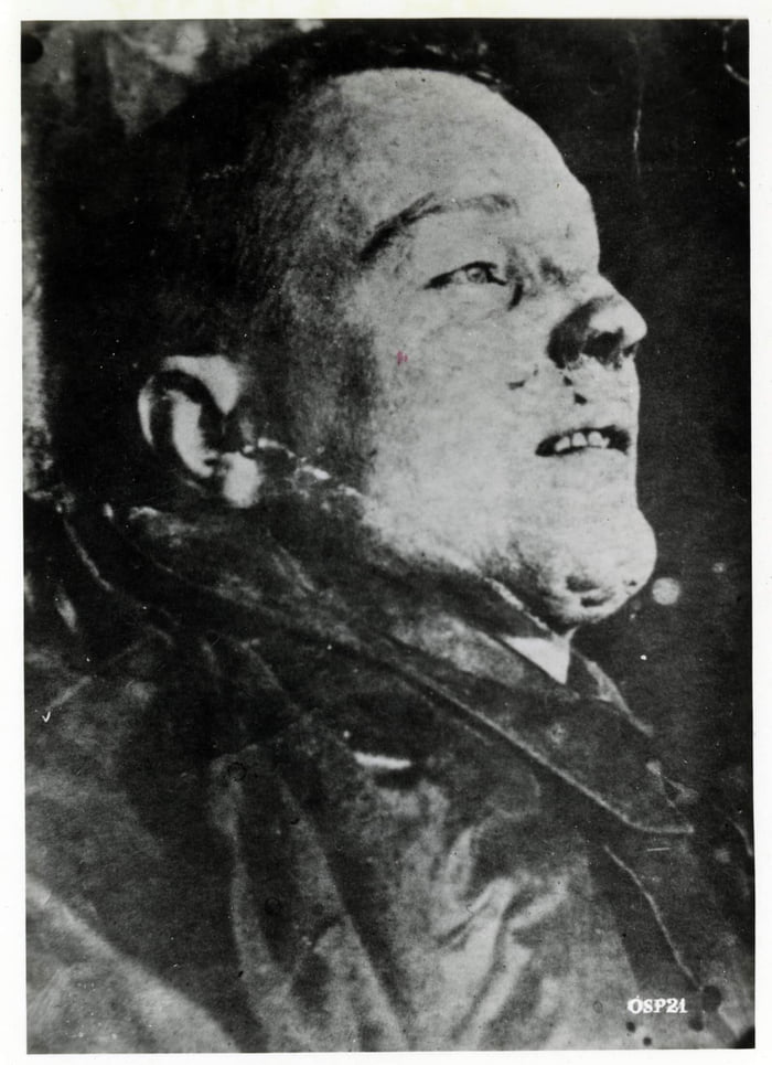 Close up of the body of Manfred von Richthofen, the "Red Baron", after ...