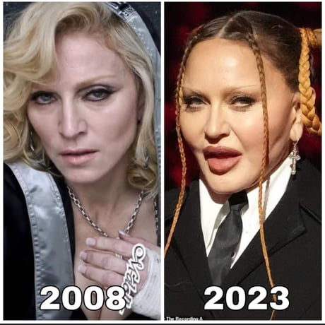 Best Funny plastic surgery Memes - 9GAG