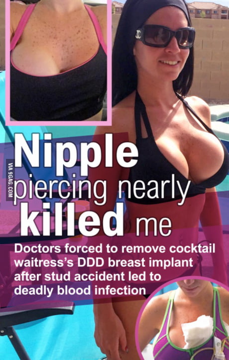 Ddd Breast Implants