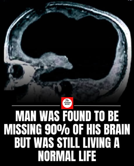 Best Funny brain Memes - 9GAG