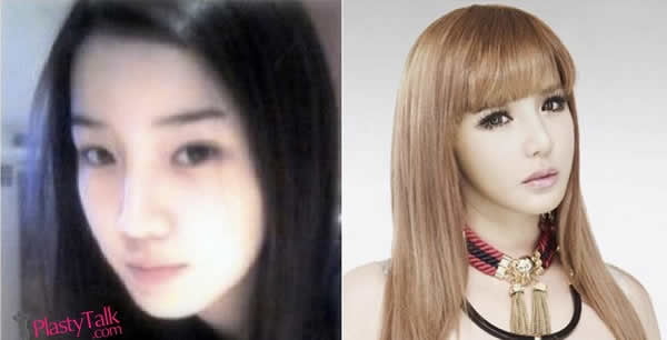 Startling Before-And-After Photos Of Cosmetic Surgery - 9GAG