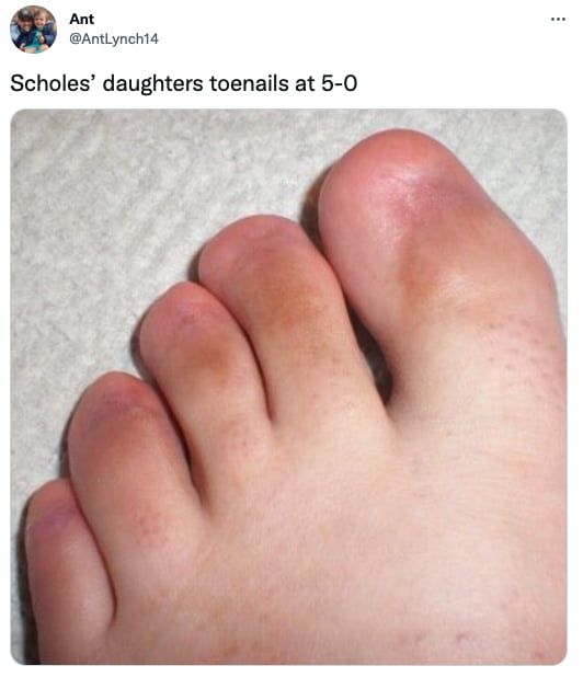 Paul Scholes Horrifies Fans By Chewing Daughter's Toenails - 9GAG