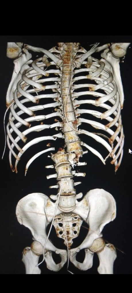 Best Funny spine Memes - 9GAG