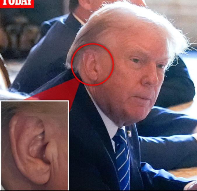 Trumps ear perfectly healed, hmm 🤔 - 9GAG