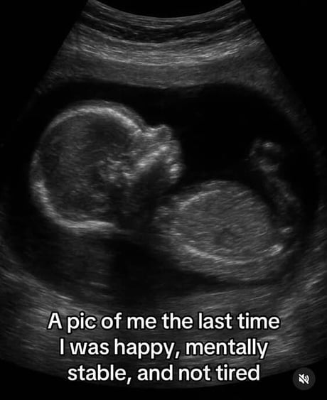 Best Funny ultrasound Memes - 9GAG