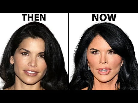 Best Funny botox Memes - 9GAG